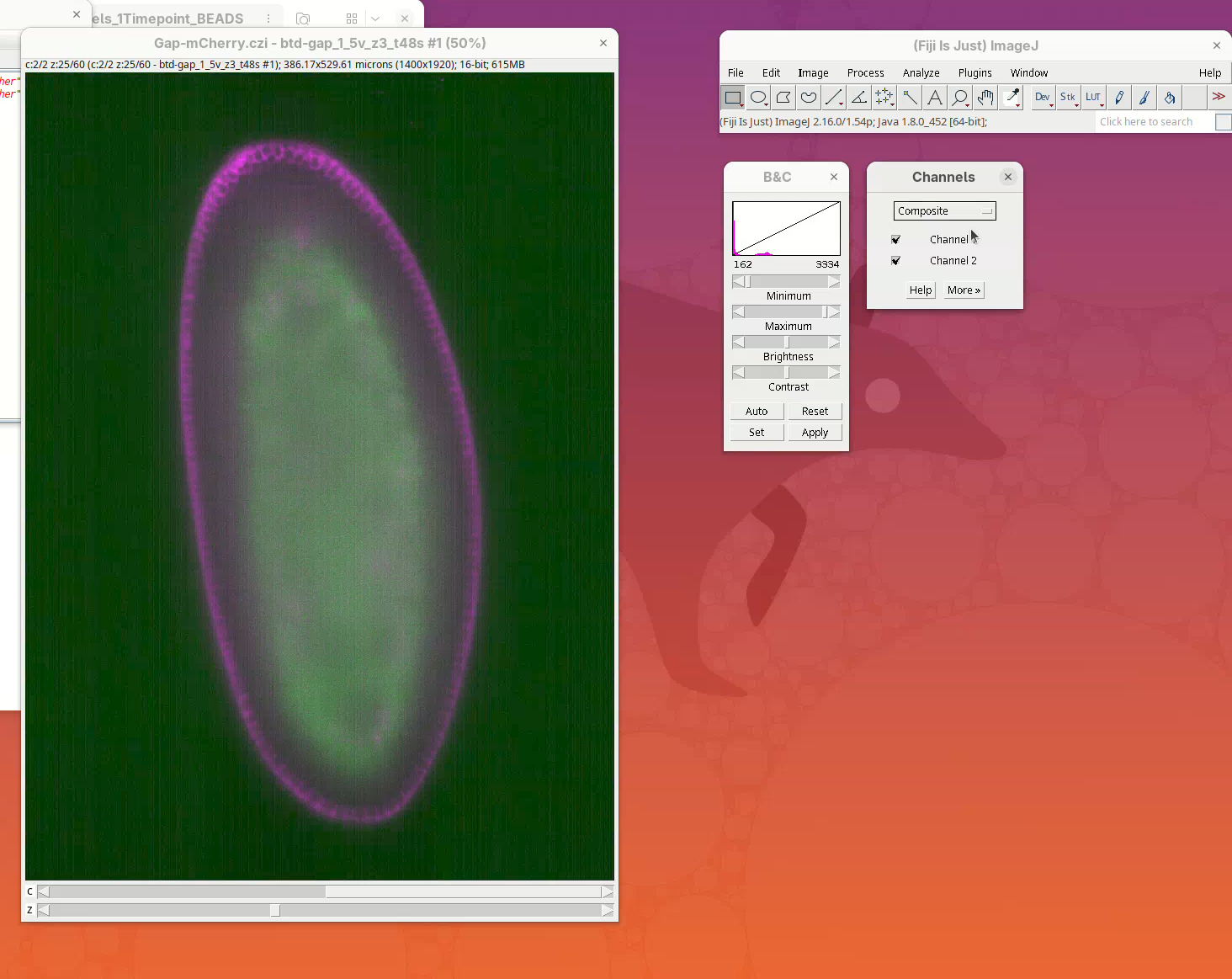 Multiview reconstruction in Fiji using BigStitcher