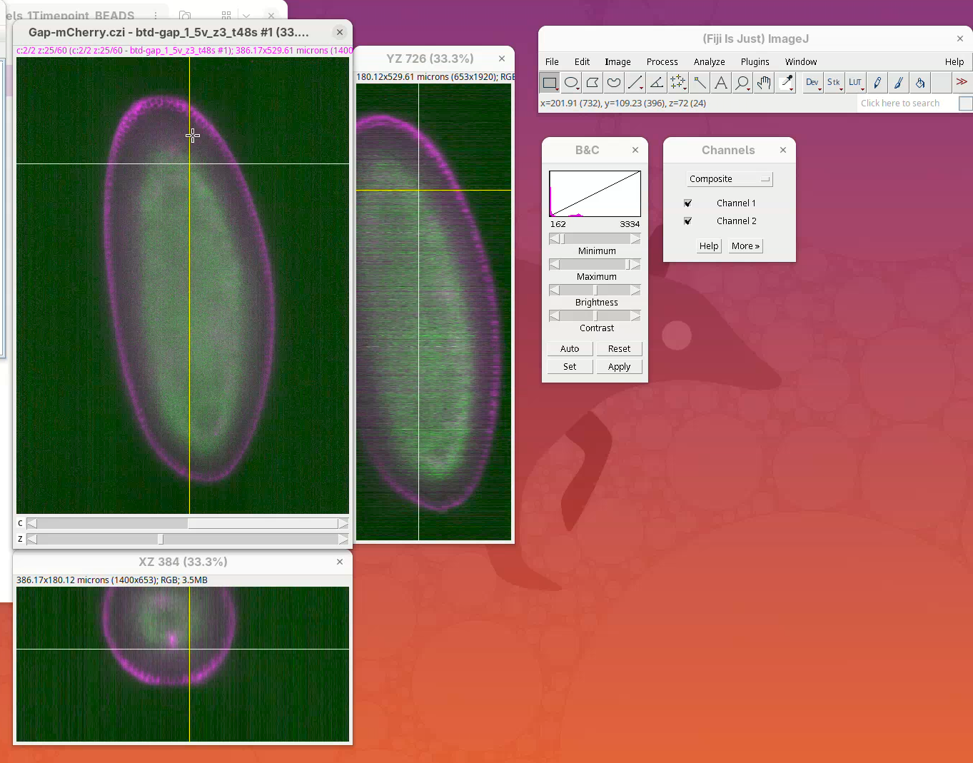Multiview reconstruction in Fiji using BigStitcher